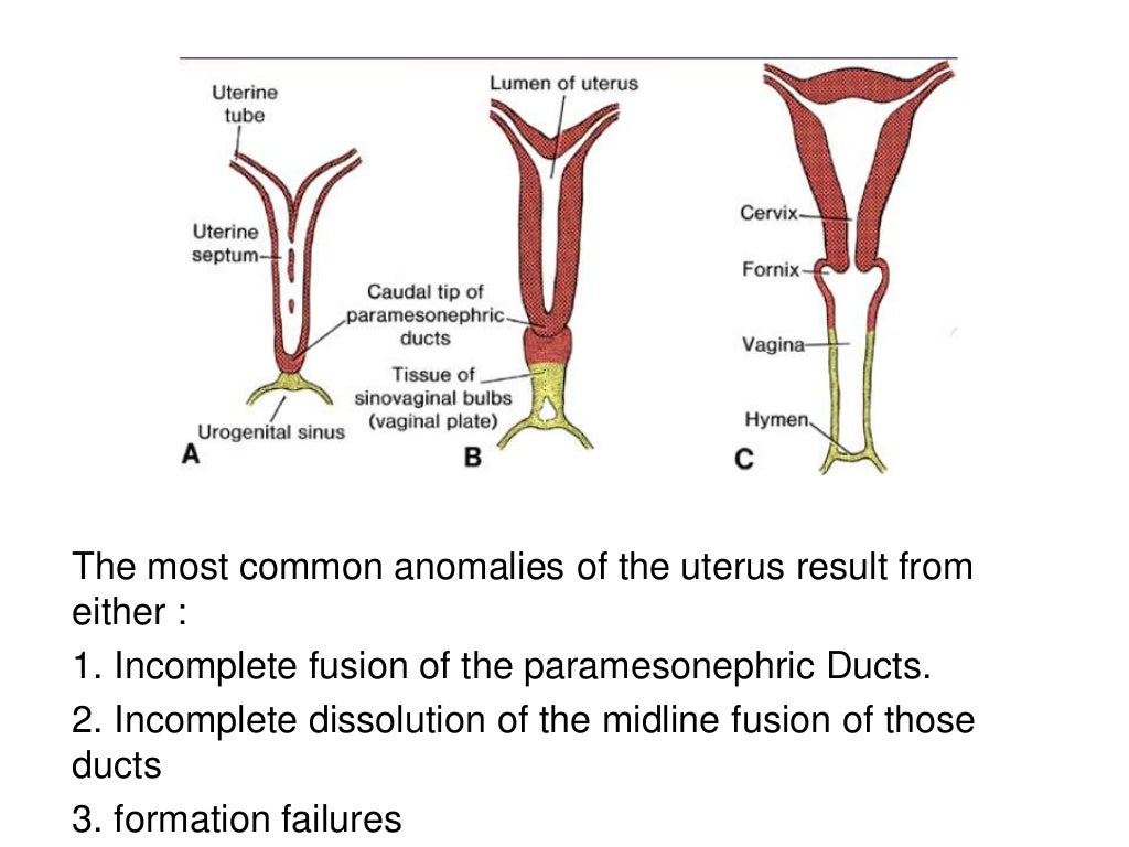 Congenital anomalies of female reproductive system