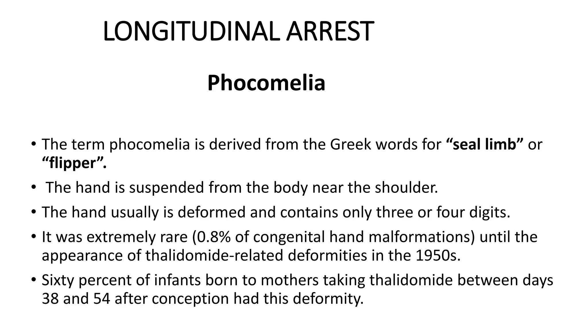 Congenital anomalies of the hand | PPTX
