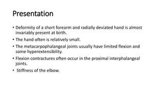 Congenital anomalies of the hand | PPTX