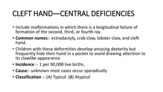 Congenital anomalies of the hand | PPTX