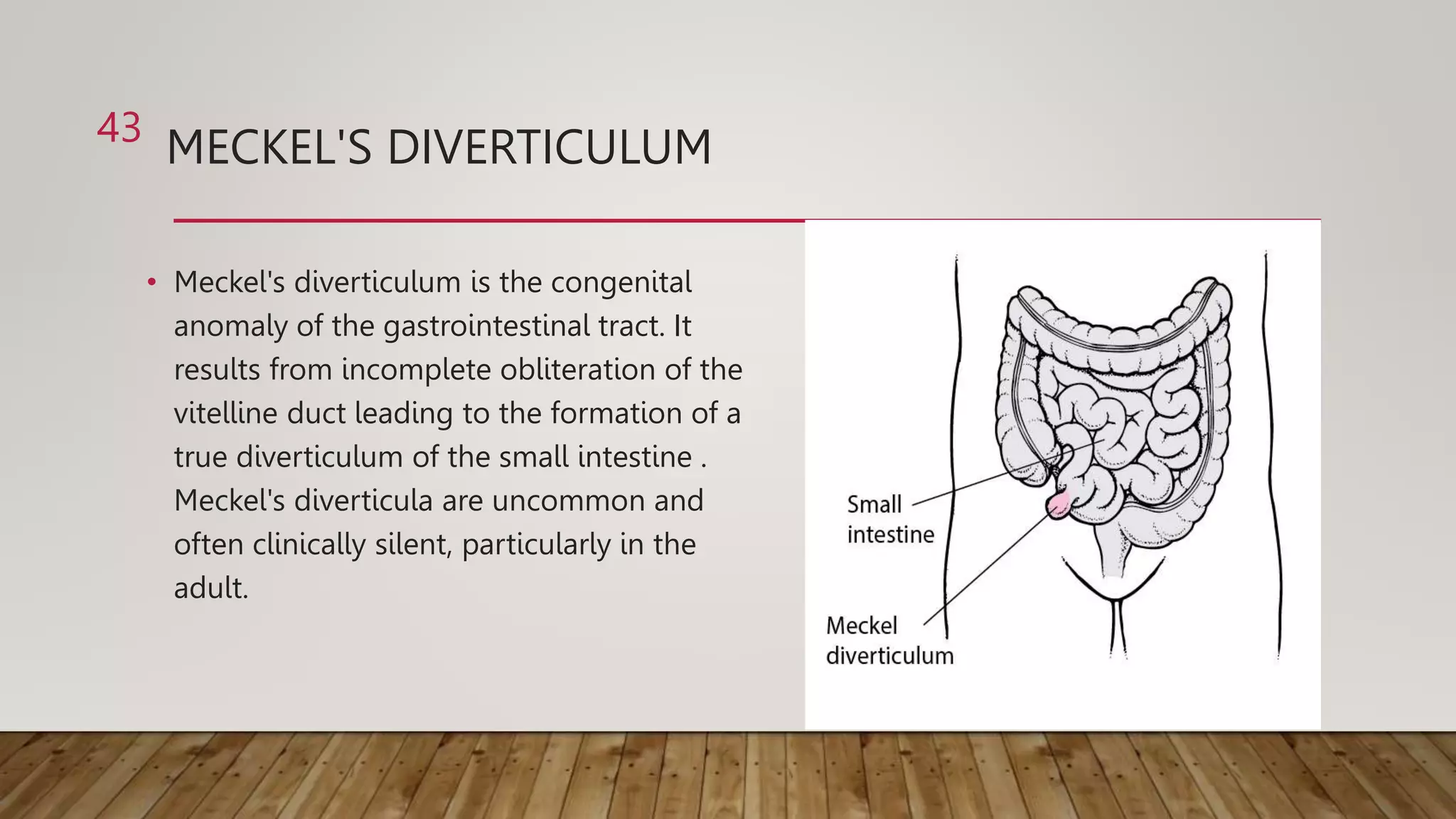 congenital anomalies of intestine ppt.pptx