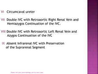 Congenital anomalies of IVC | PPTX