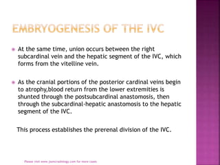 Congenital anomalies of IVC | PPTX