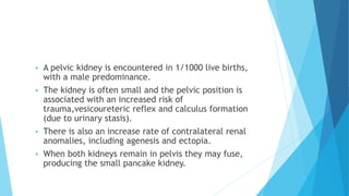 Congenital Anomalies of Kidney bt dr. shahariar | PPTX