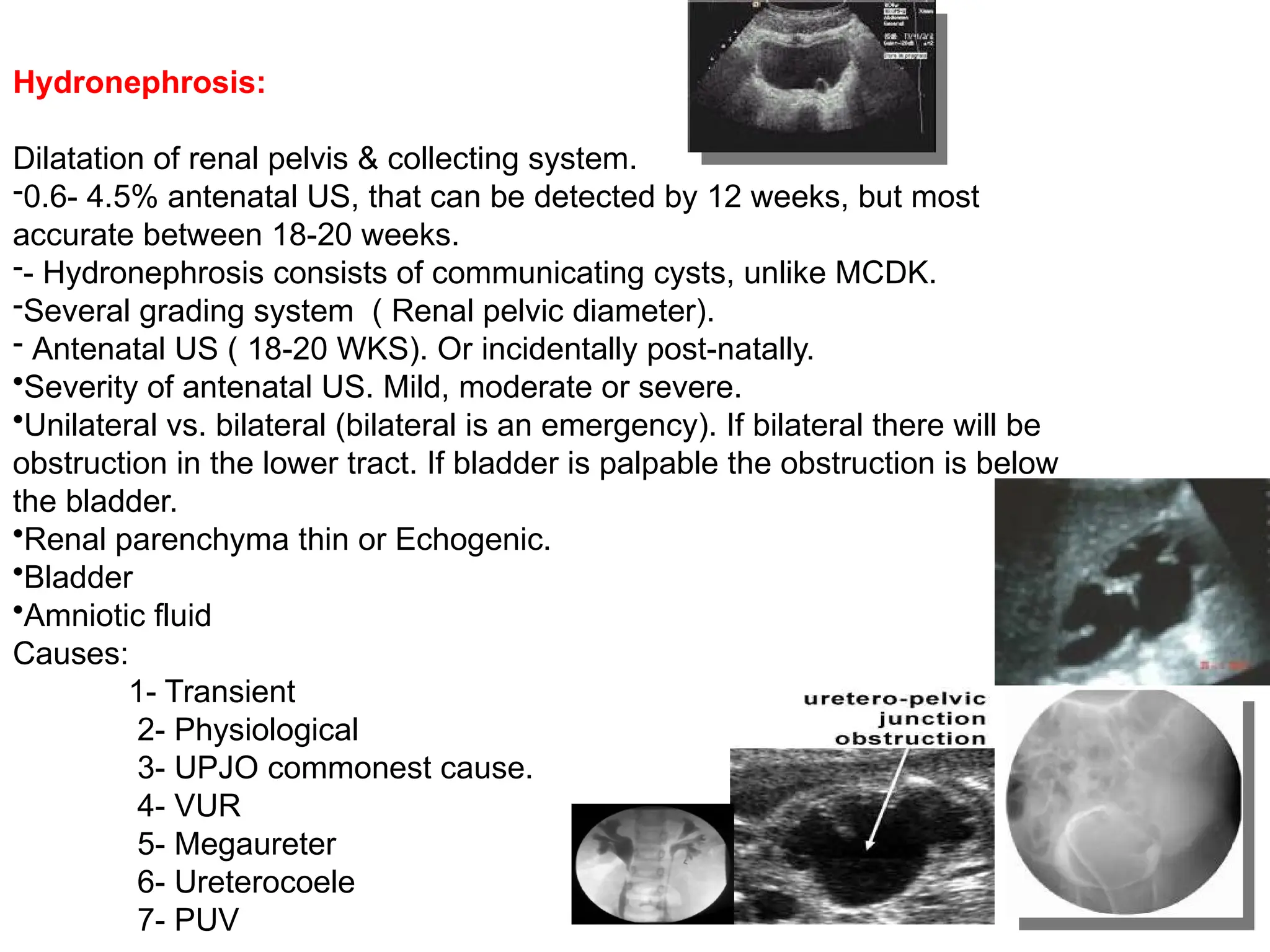 Congenital anomalies of Kidney and Urinary System.pptx