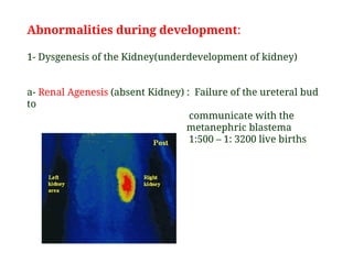 Congenital anomalies of Kidney and Urinary System.pptx