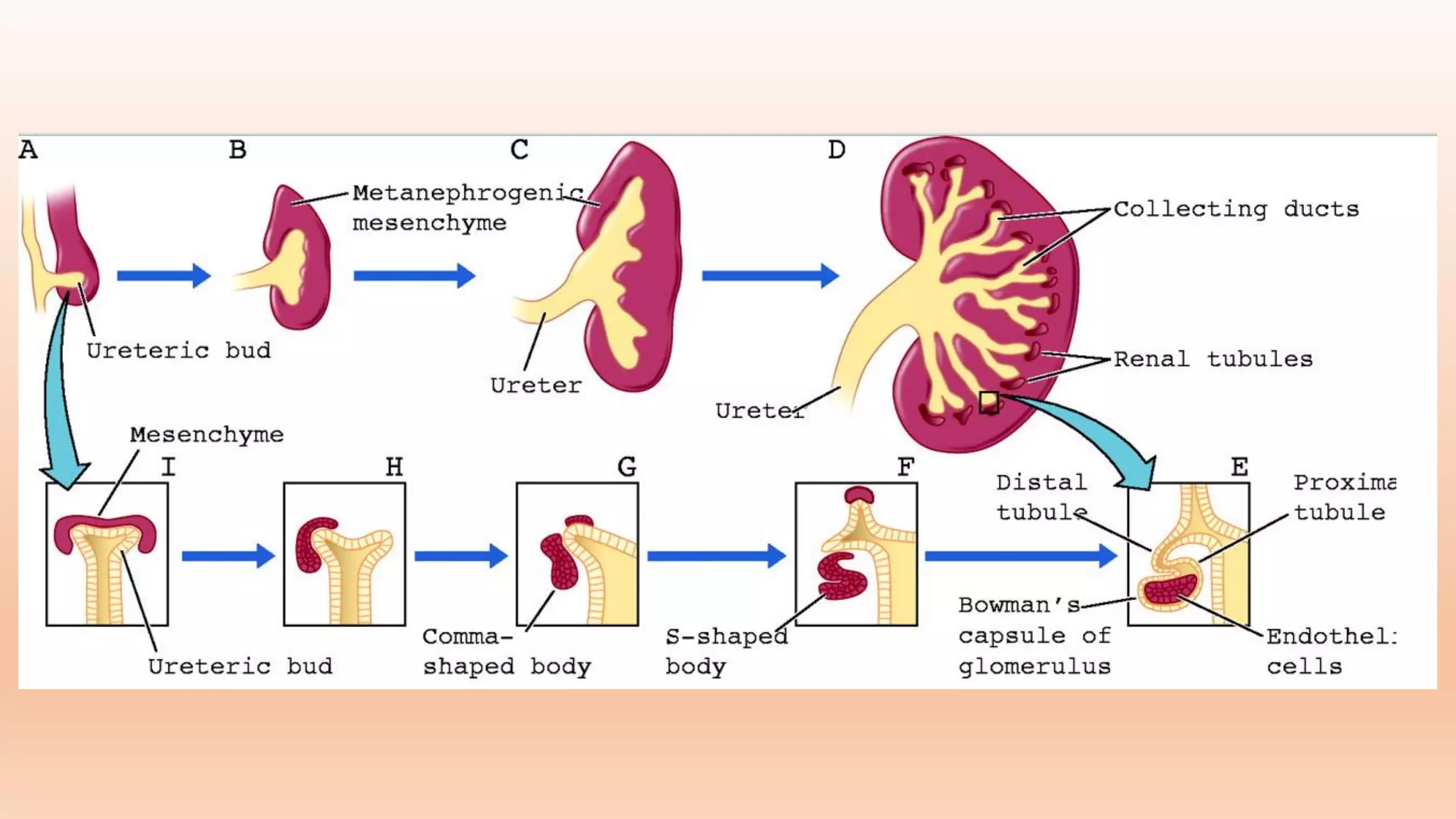 Congenital anomalies of kidney and urinary tract | PDF