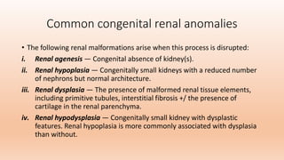 Congenital anomalies of kidney and urinary tract | PDF