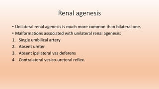 Congenital anomalies of kidney and urinary tract | PDF