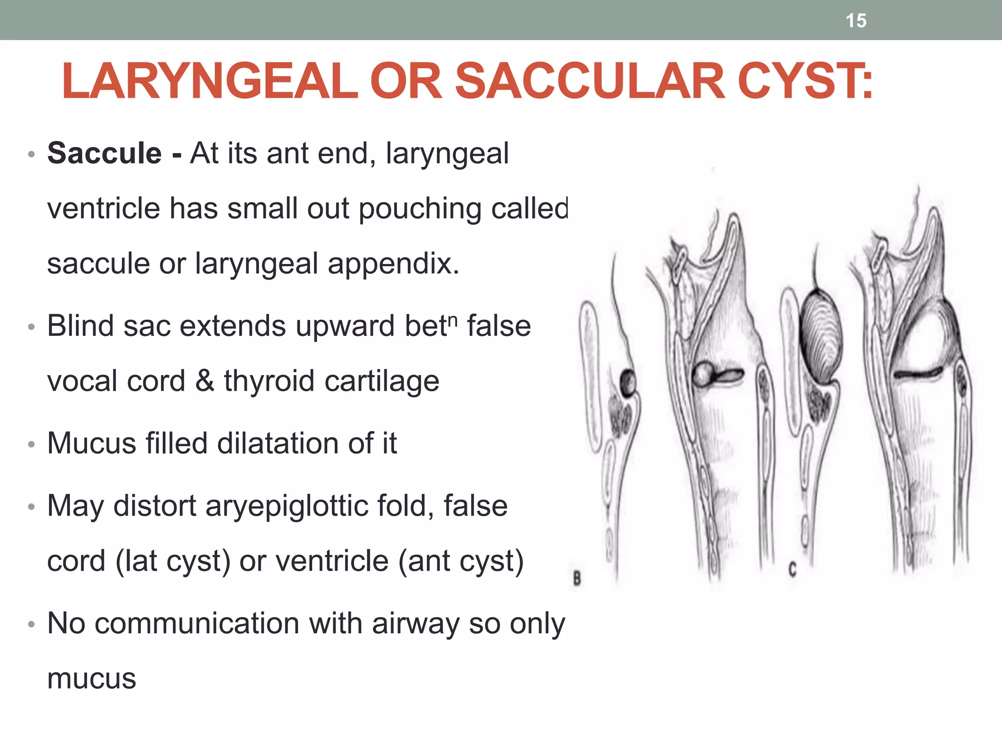 Congenital anomalies of larynx | PPTX