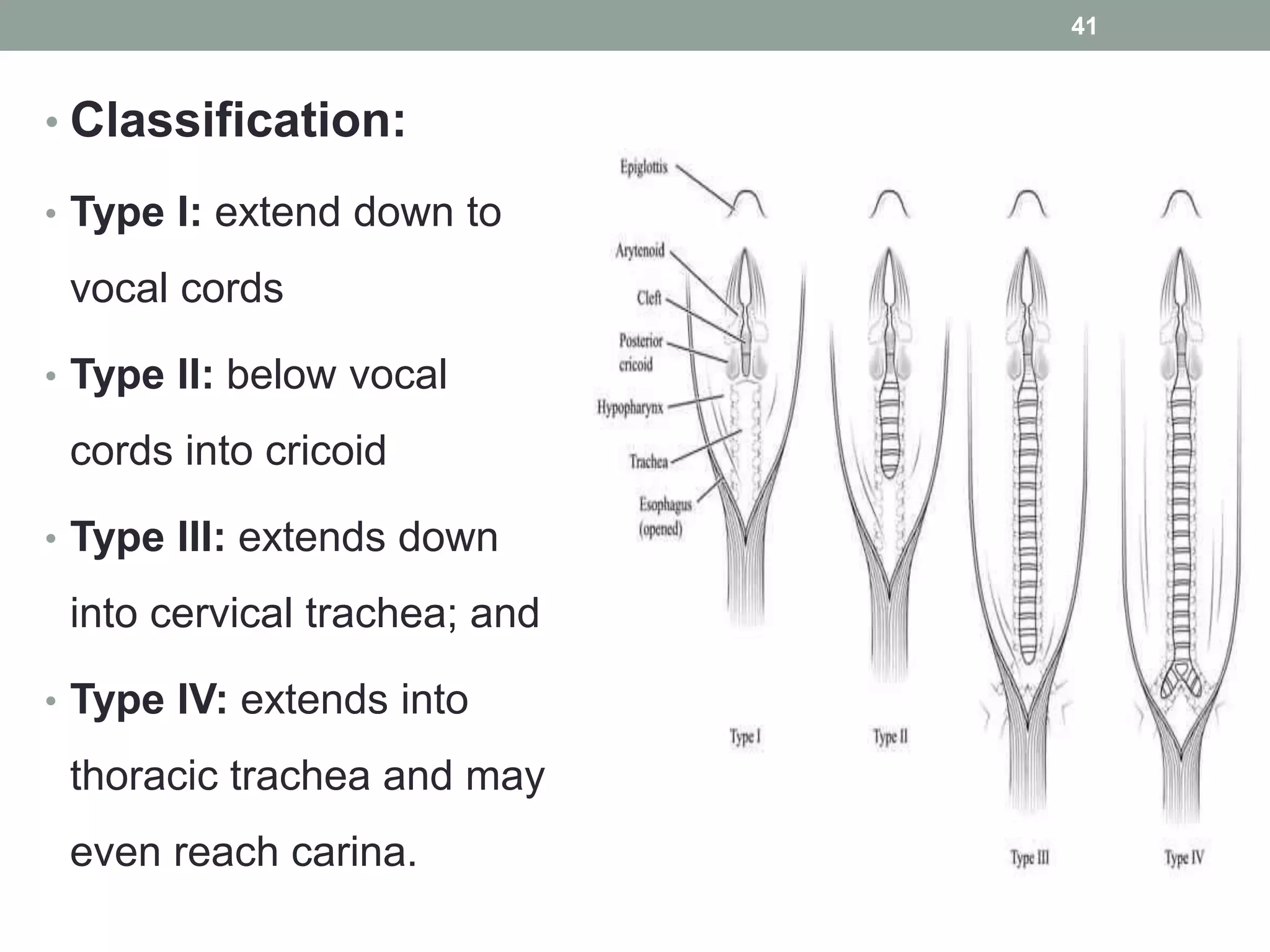 Congenital anomalies of larynx | PPTX | Ear, Nose and Throat Conditions ...