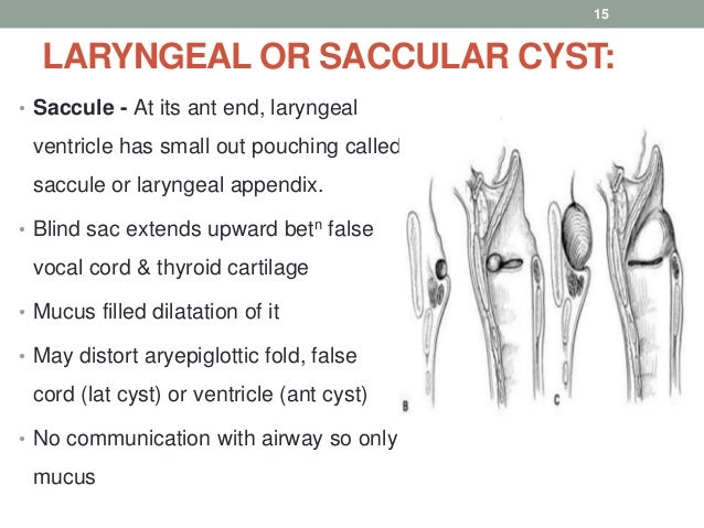 Congenital anomalies of larynx