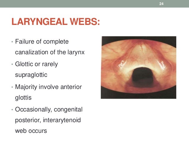 Congenital anomalies of larynx