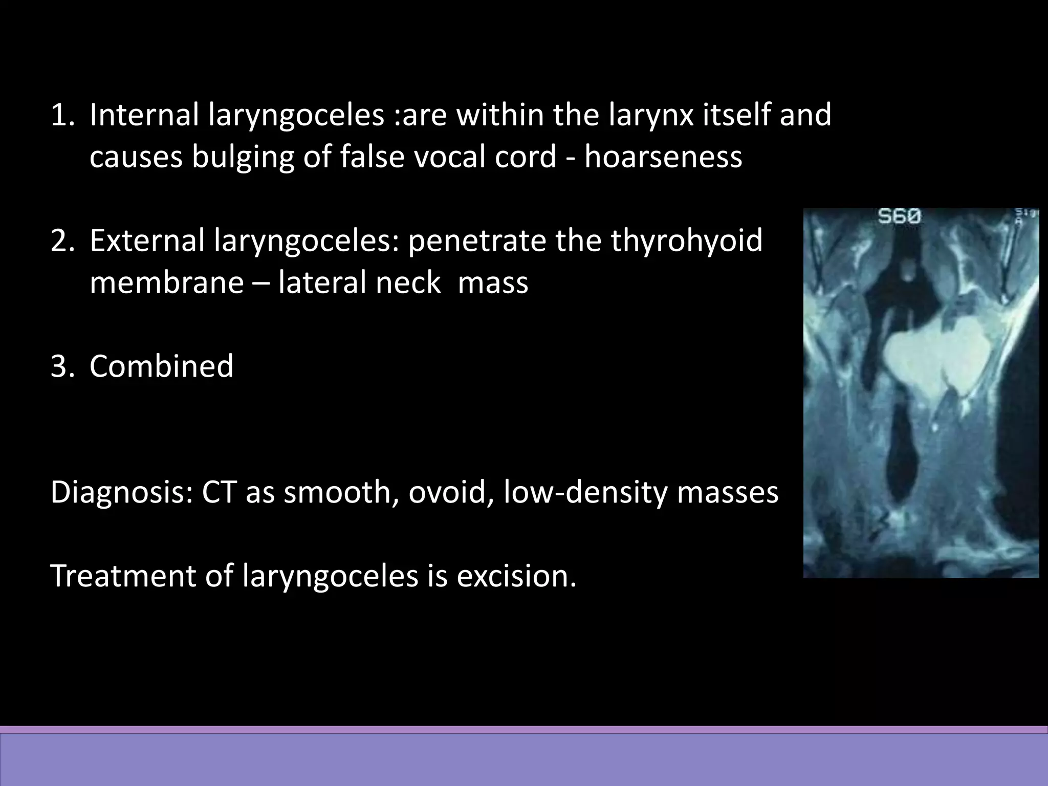 Congenital anomalies of larynx.pptx