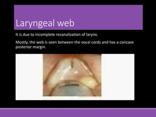 Congenital anomalies of larynx.pptx