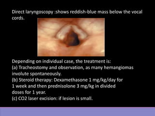 Congenital anomalies of larynx.pptx