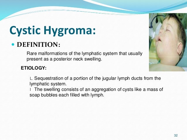 Congenital anomalies of neck
