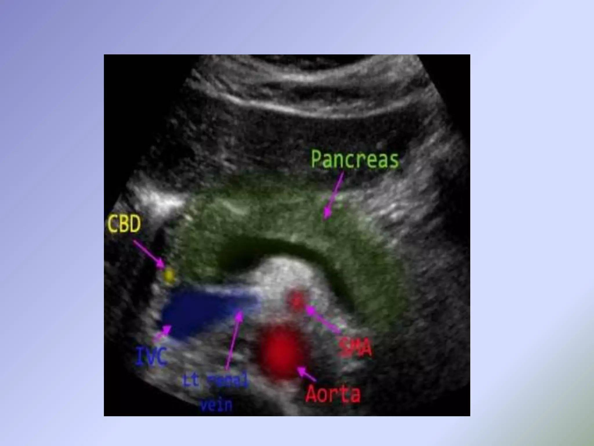 Congenital anomalies of pancreas and hepatobiliary system radiology | PPTX