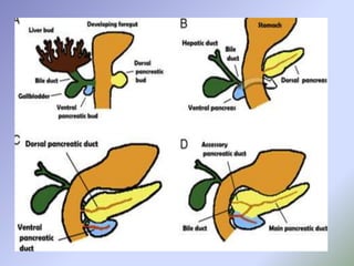 Congenital anomalies of pancreas and hepatobiliary system radiology | PPT