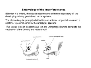 Congenital Anomalies of rectum &Anal Canal.pptx