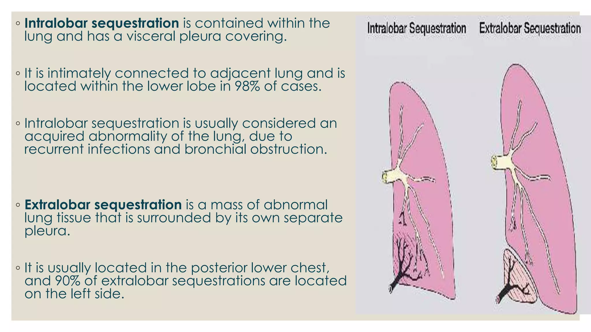 Congenital anomalies of respiratory system A Radiological approach | PDF