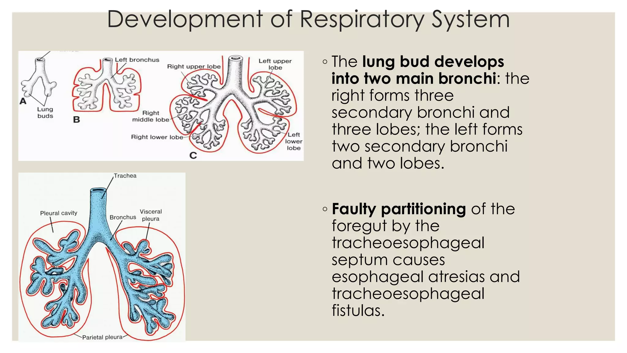 Congenital anomalies of respiratory system A Radiological approach | PDF