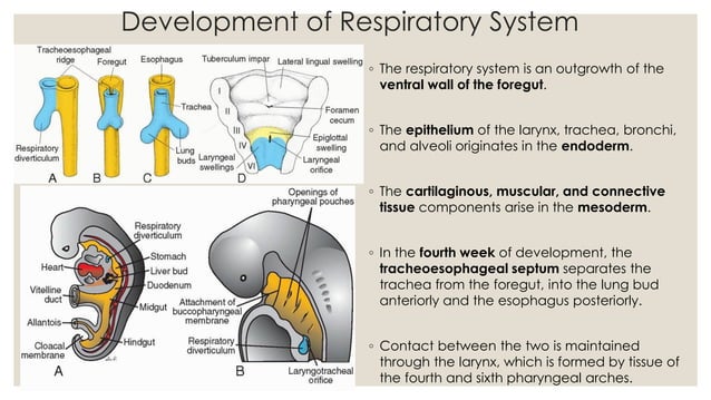 Congenital anomalies of respiratory system A Radiological approach ...