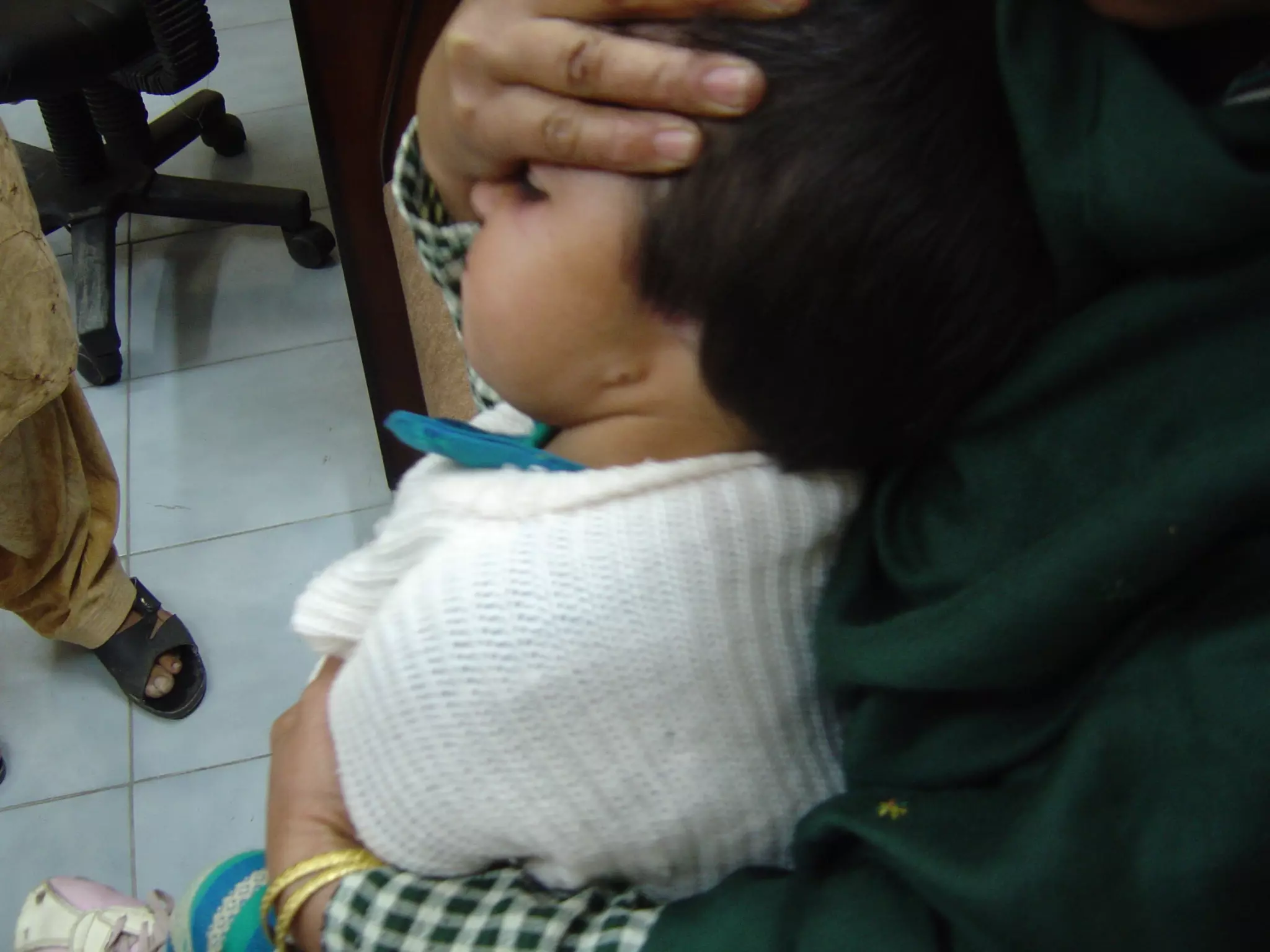 Congenital anomalies of the ear2 | PPT