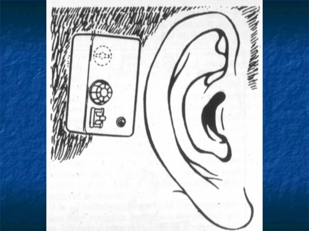 Congenital anomalies of the ear2 | PPT