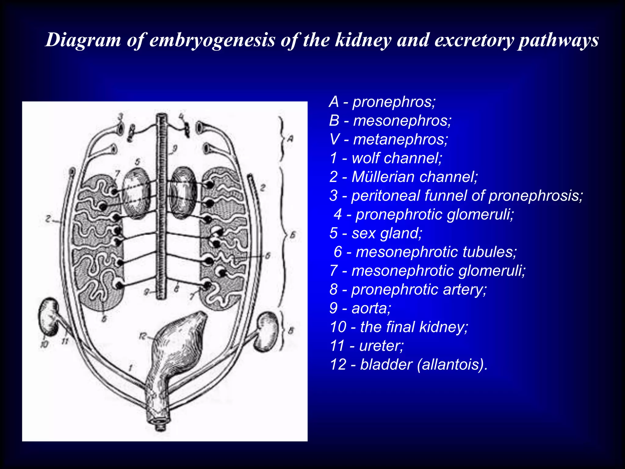 Congenital Anomalies of the Kidney and the Urinary Tract (CAKUT).ppt
