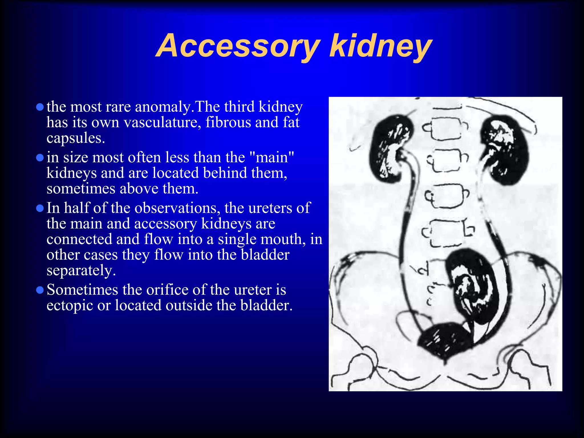 Congenital Anomalies of the Kidney and the Urinary Tract (CAKUT).ppt