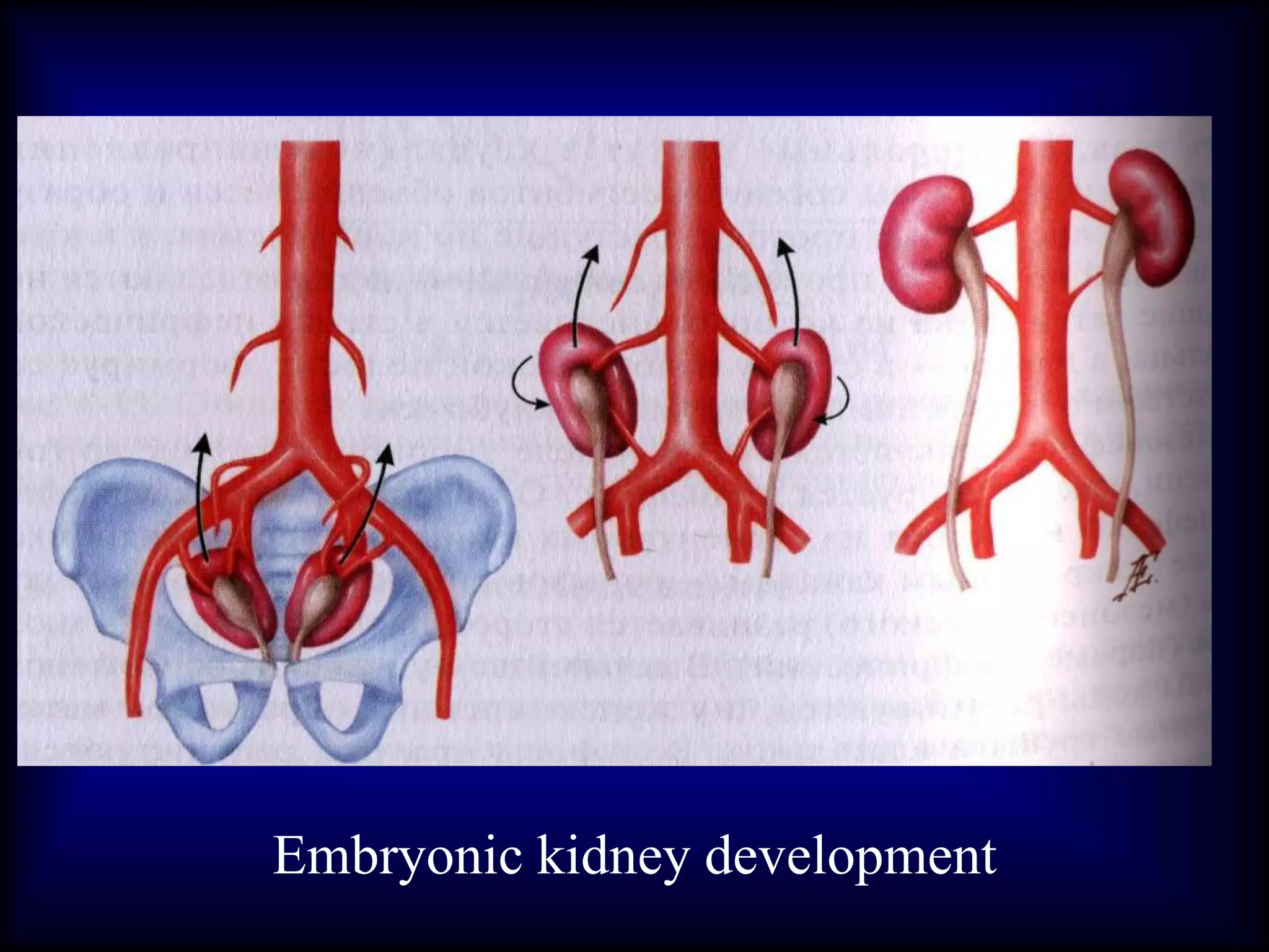 Congenital Anomalies of the Kidney and the Urinary Tract (CAKUT).ppt