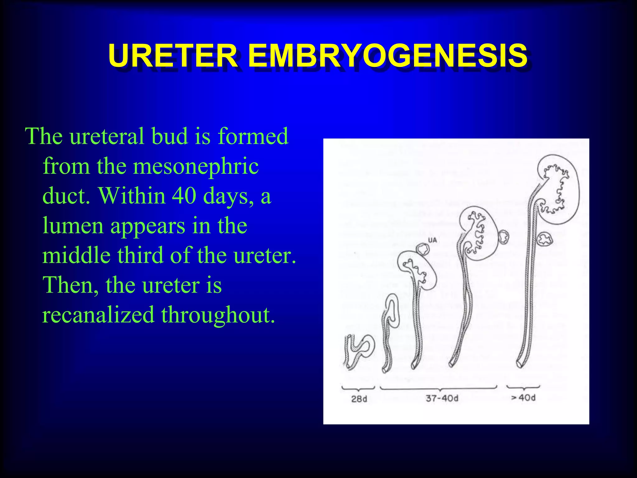 Congenital Anomalies of the Kidney and the Urinary Tract (CAKUT).ppt