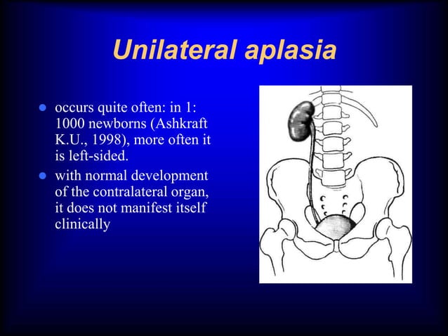Congenital Anomalies of the Kidney and the Urinary Tract (CAKUT).ppt ...