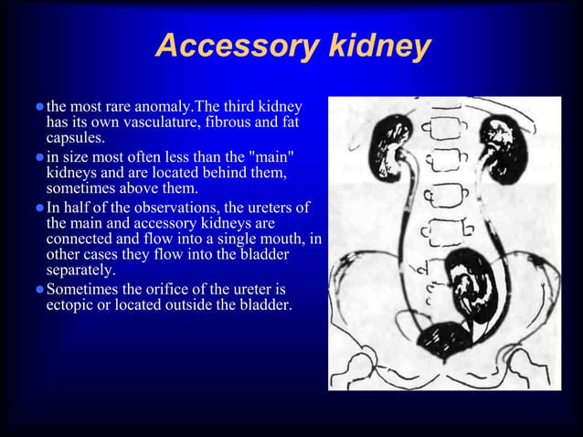 Congenital Anomalies of the Kidney and the Urinary Tract (CAKUT).ppt ...