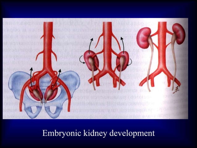 Congenital Anomalies of the Kidney and the Urinary Tract (CAKUT).ppt ...