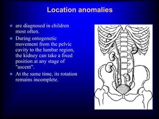 Congenital Anomalies of the Kidney and the Urinary Tract (CAKUT).ppt
