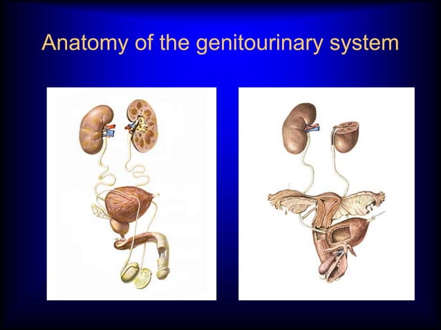 Congenital Anomalies of the Kidney and the Urinary Tract (CAKUT).ppt ...