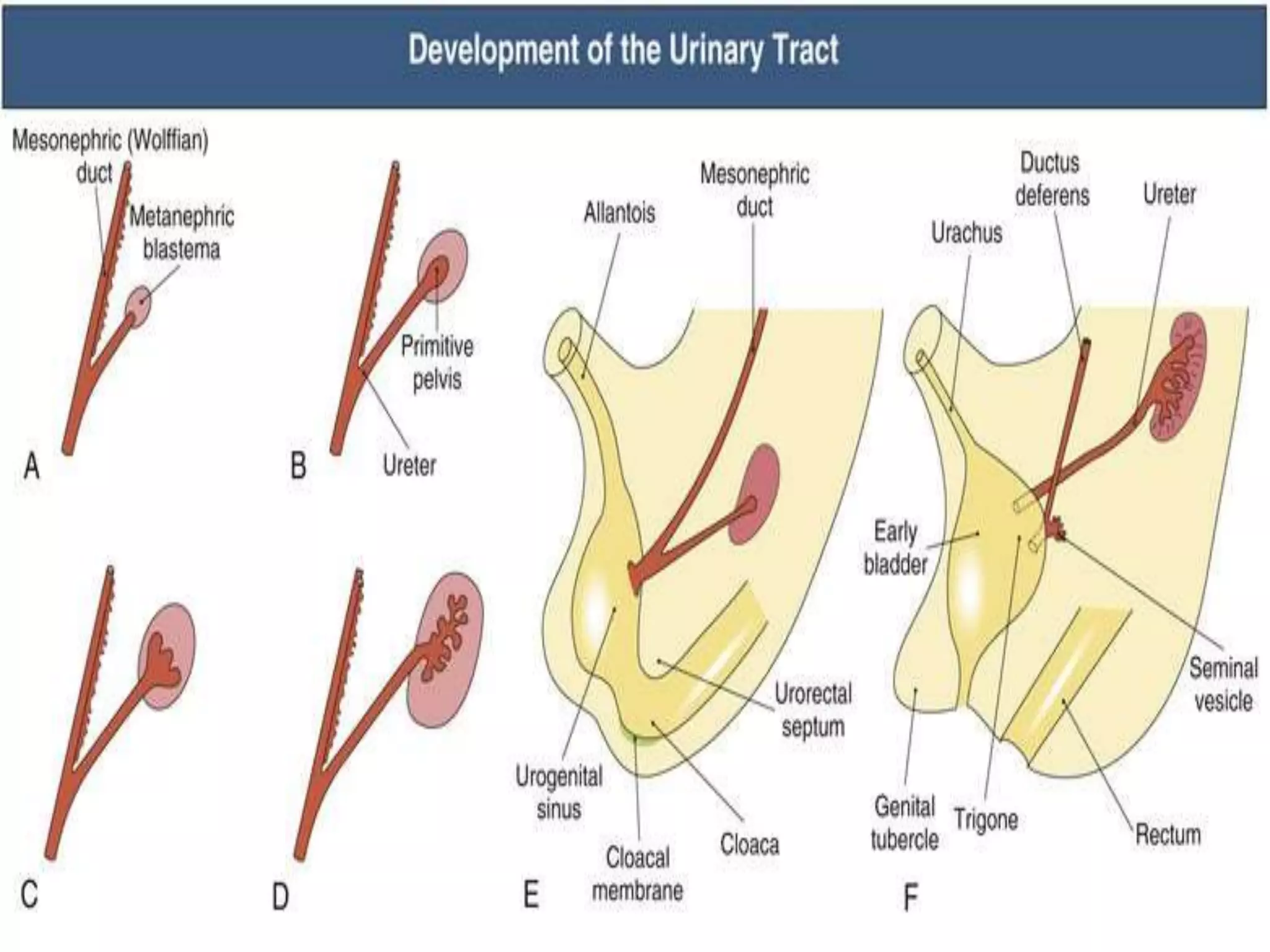Congenital anomalies of the kidney and urinary tract | PPTX