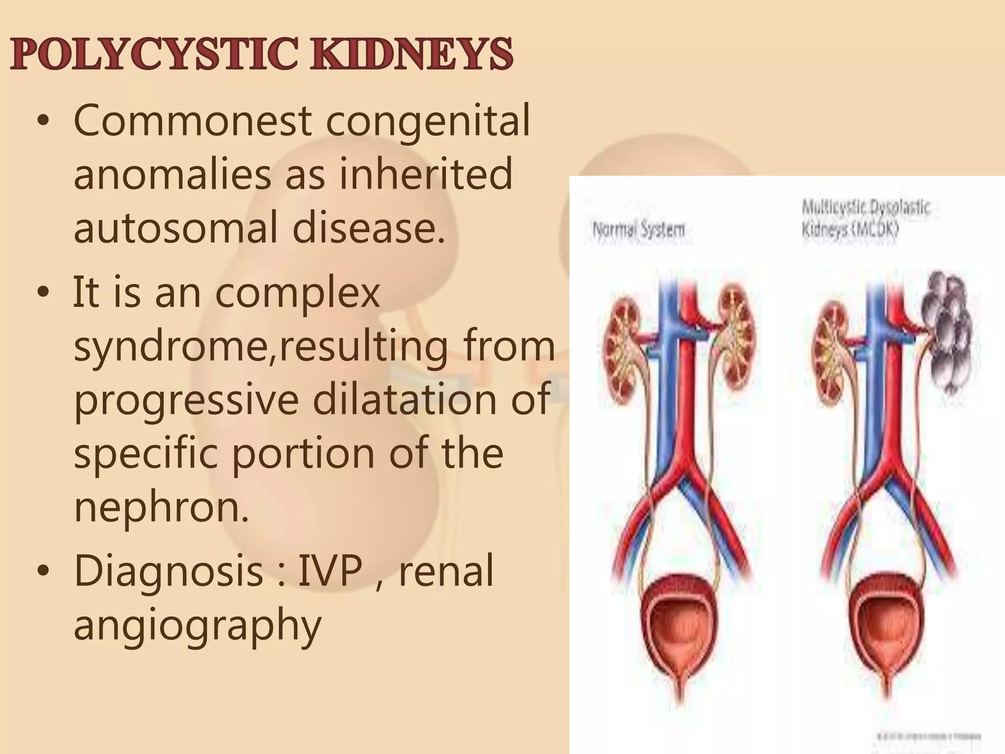 Congenital anomalies of the kidney and urinary tract | PPTX