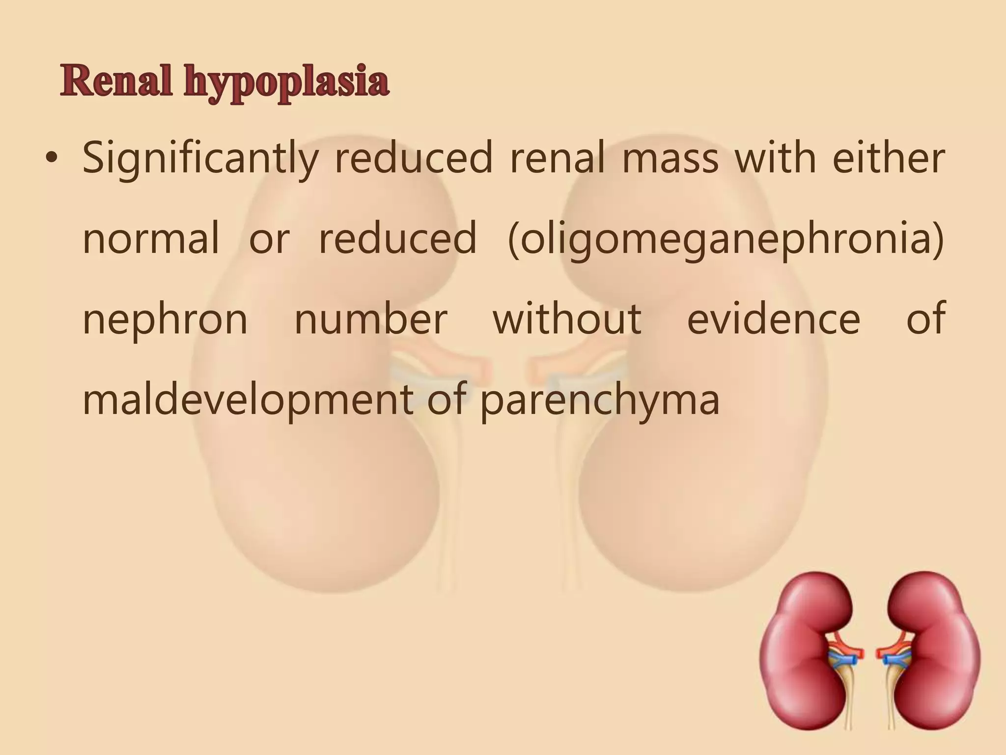 Congenital anomalies of the kidney and urinary tract | PPTX