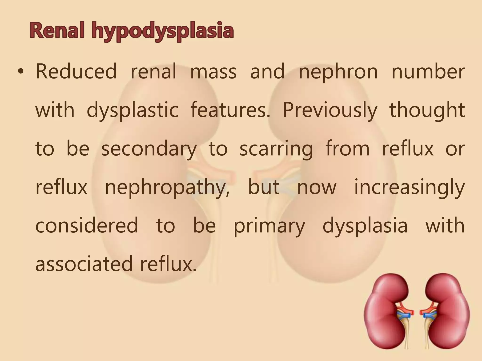 Congenital anomalies of the kidney and urinary tract | PPTX