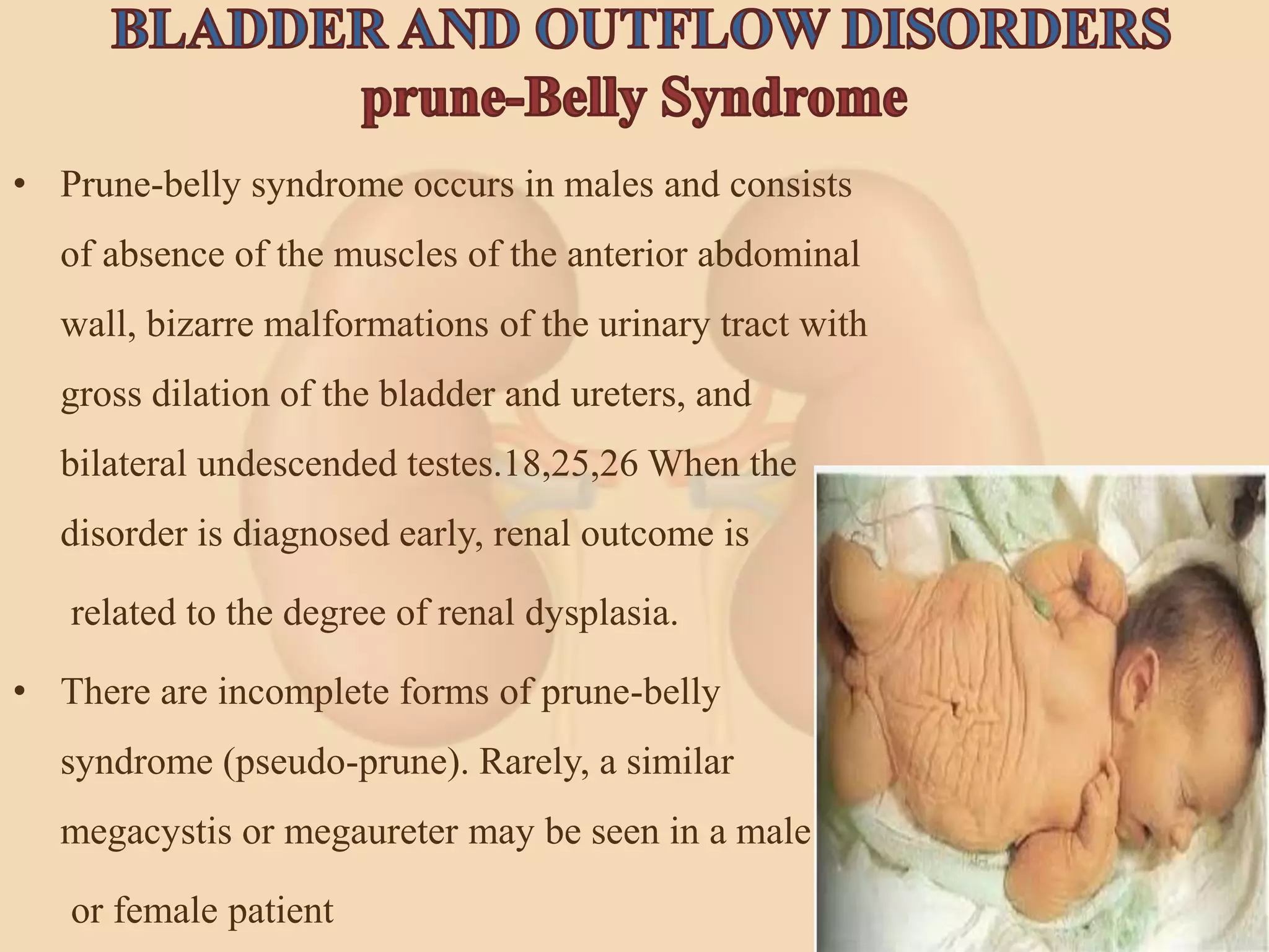 Congenital anomalies of the kidney and urinary tract | PPTX