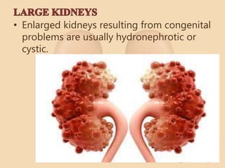 Congenital anomalies of the kidney and urinary tract | PPTX
