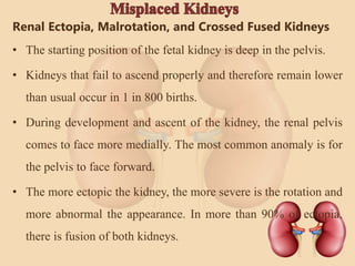 Congenital anomalies of the kidney and urinary tract | PPTX