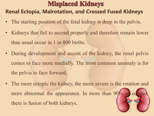 Congenital anomalies of the kidney and urinary tract | PPTX