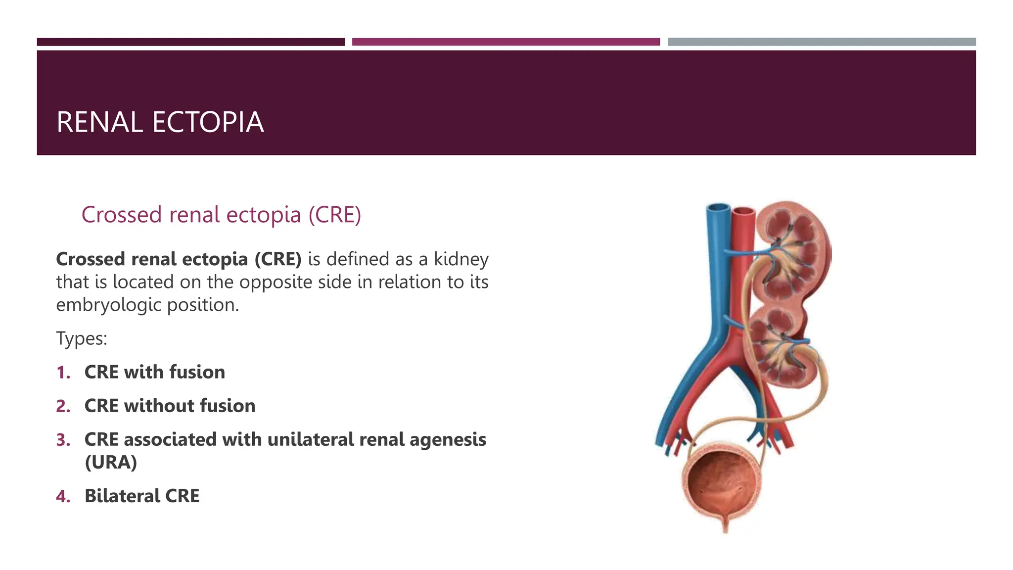 Congenital Anomalies of the Kidney & Urinary Tract | PPTX