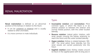 Congenital Anomalies of the Kidney & Urinary Tract | PPTX