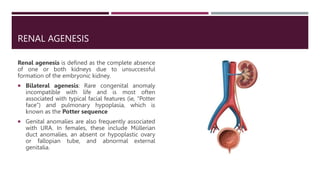 Congenital Anomalies of the Kidney & Urinary Tract | PPTX