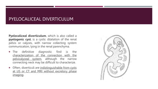 Congenital Anomalies of the Kidney & Urinary Tract | PPTX